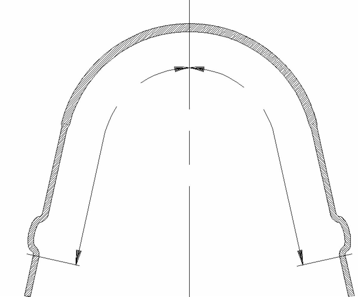 3M™ Series 5 Facebows, 328-252, .045 in, Inner Bow Size 5, Outer Bow 0 ...