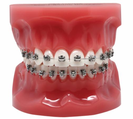 3M™ Typodont, Unitek™ Miniature Twin Brackets, 600-213, 1/Ea | 3M Indonesia