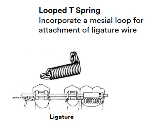 3M™ Unitek™ T Spring | 3M Malaysia