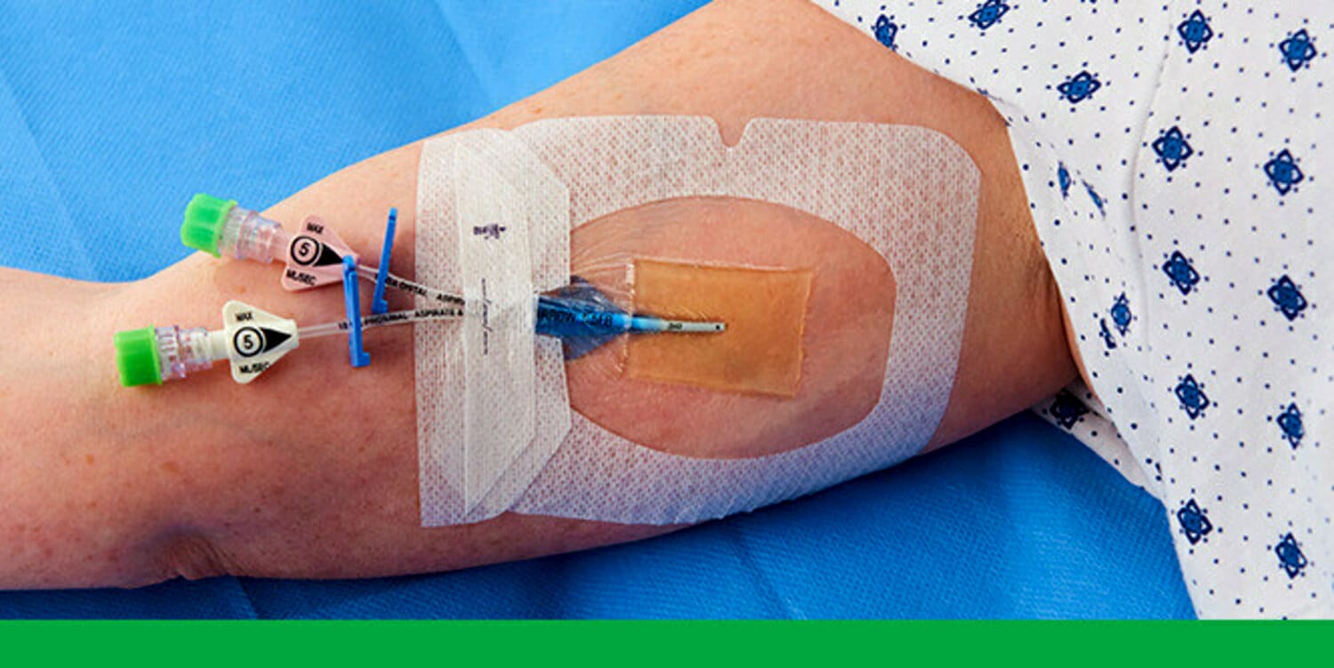 3M™ Tegaderm™ CHG Chlorhexidine Gluconate I.V. Securement Dressing 1658, 25/Carton 4 Cartons ...